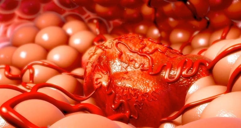 Understanding The Absolute Neutrophil Count (ANC) GlobalRPH